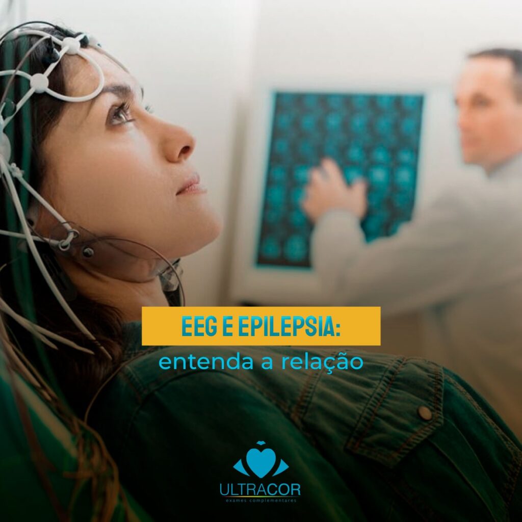 EEG e Epilepsia: entenda a relação - Ultracor